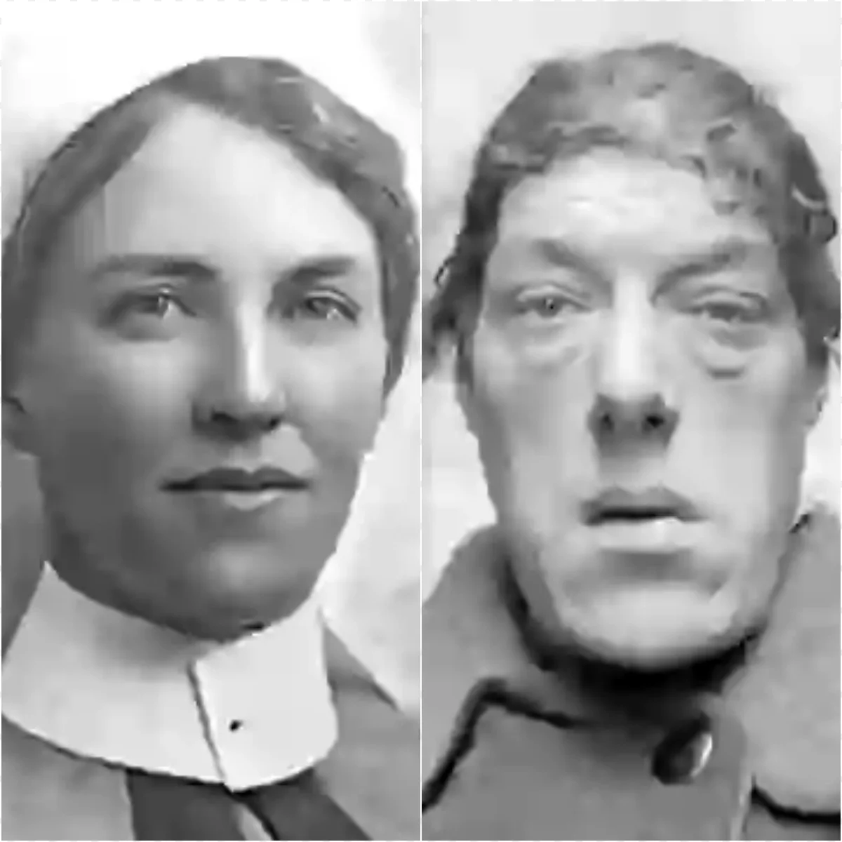 A Freak Medical Condition Gave Her a Second Face – The Unbelievable ...