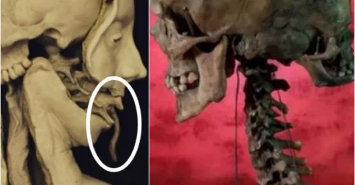 Unraveling the Mystery of the Two-Headed Skull: Examining ...