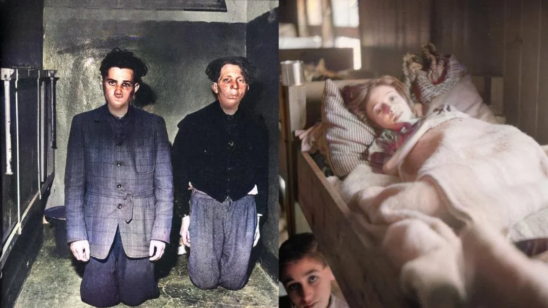 THE SECRET “DEATH NEEDLE” OF AUSCHWITZ: How SS Doctors Used Phenol ...